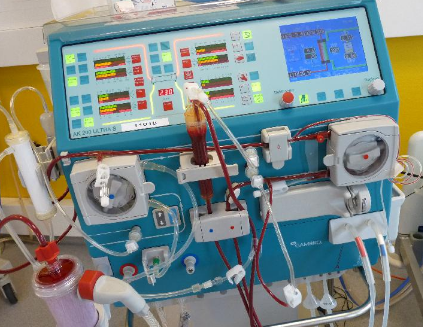 Comment fonctionne un appareil d’hémodialyse ? – Épode