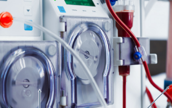Comment fonctionne un appareil d’hémodialyse
